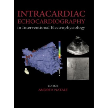 Intracardiac Echocardiography in Interventional Electrophysiology ...